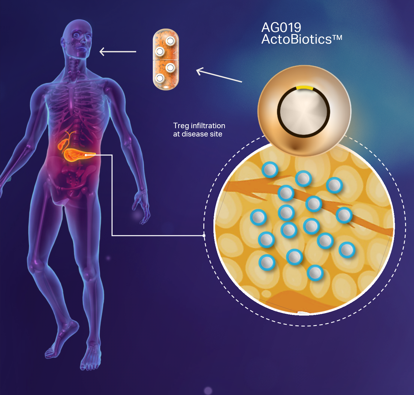 Precigen advancing pipeline of gene and cell therapies in I-O ...