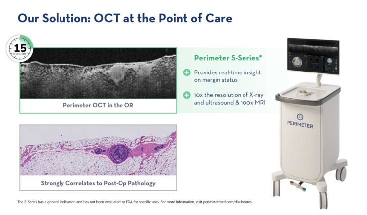 Perimeter aims to transform cancer surgery with ultra-high-res imaging ...